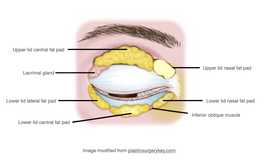 Orbital Adipose Tissue - EyeWiki