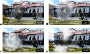 Ophthalmologic Manifestations of Epilepsy - EyeWiki