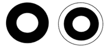 Compressive Visual Field Defects - EyeWiki