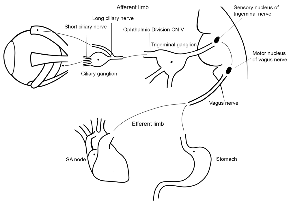 Oculocardiac Reflex Eyewiki