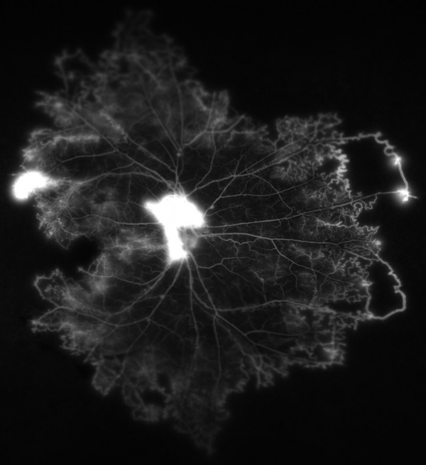 Idiopathic Retinitis, Vasculitis, Aneurysms, and Neuroretinitis (IRVAN ...