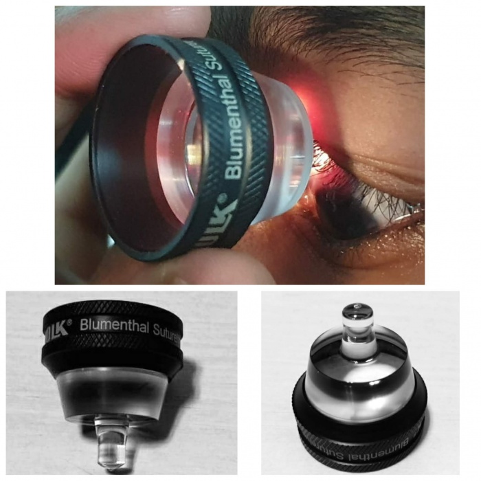 Laser Suture Lysis Post Trabeculectomy - EyeWiki