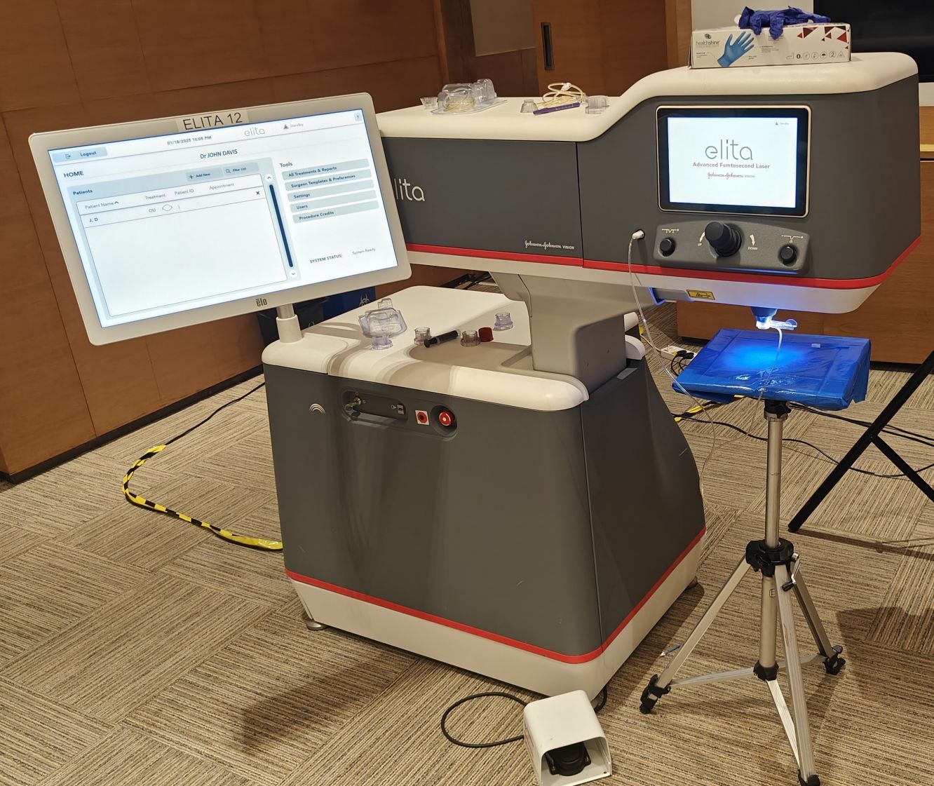 Keratorefractive Lenticule Extraction (KLEx) Surgeries - EyeWiki