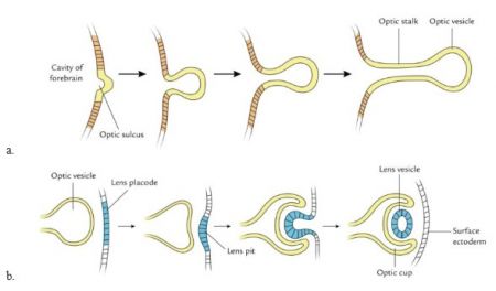 Ocular Manifestations of Ectodermal Dysplasia - EyeWiki