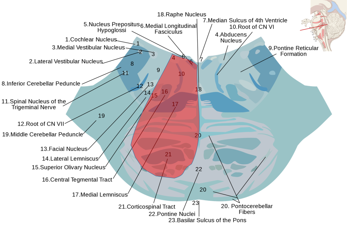 Foville Syndrome - EyeWiki