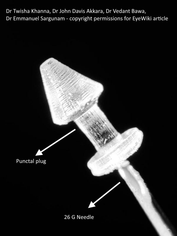 Punctal Plugs - EyeWiki